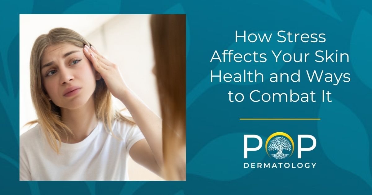 How Stress Affects Your Skin Health and Ways to Combat It